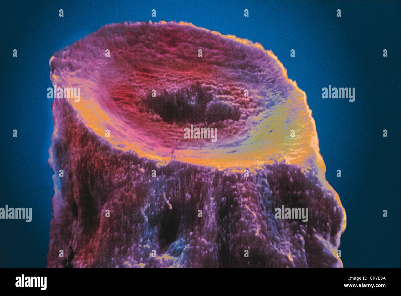 Electron microscopy vein hi-res stock photography and images - Alamy