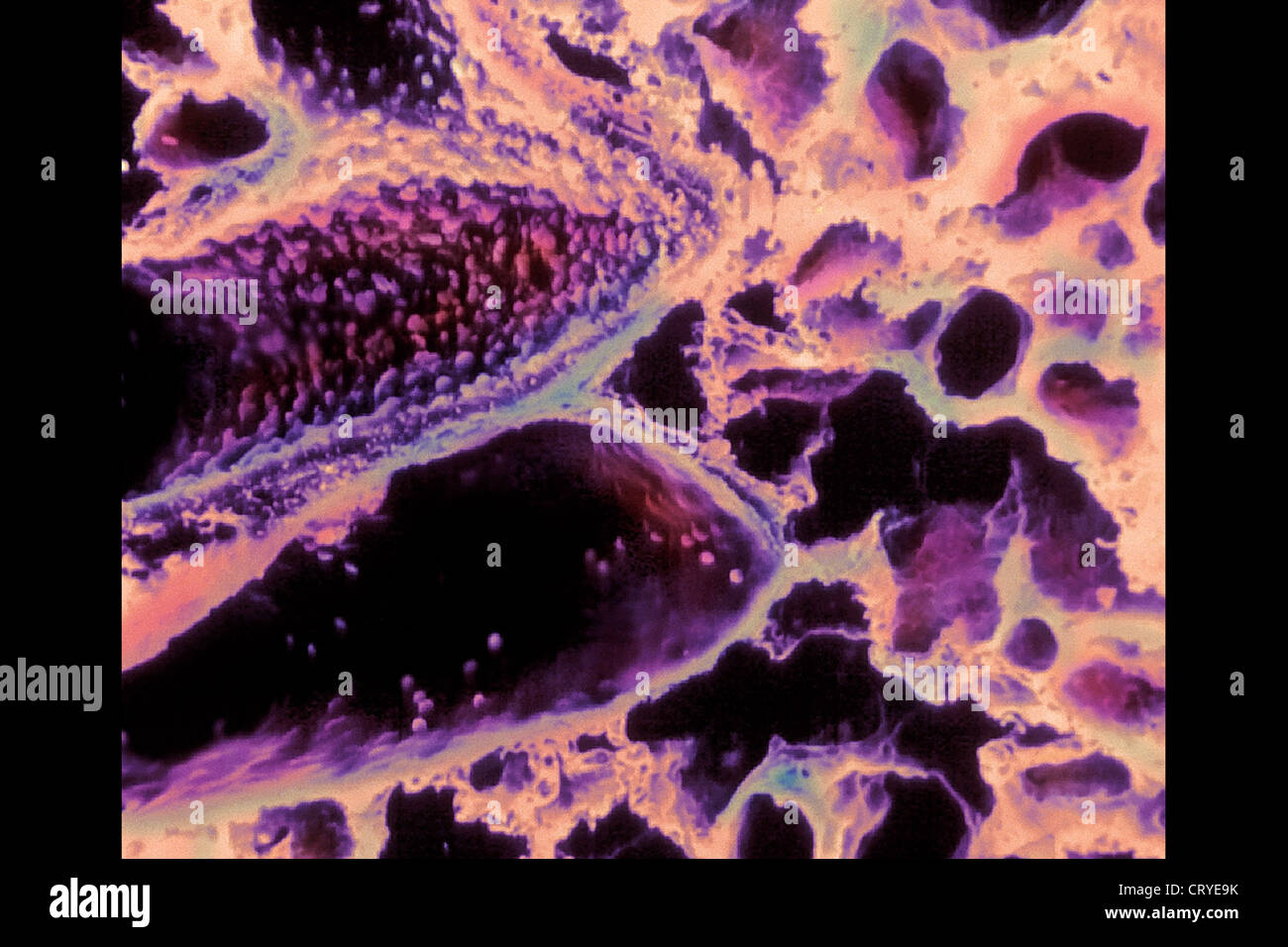 Bronchus, epithelium hi-res stock photography and images - Alamy