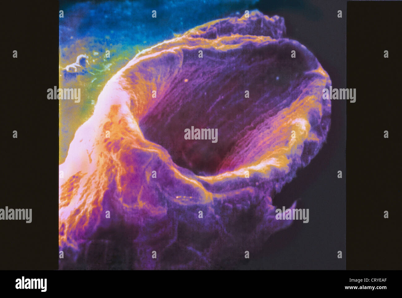 Electron microscopy vein hi-res stock photography and images - Alamy