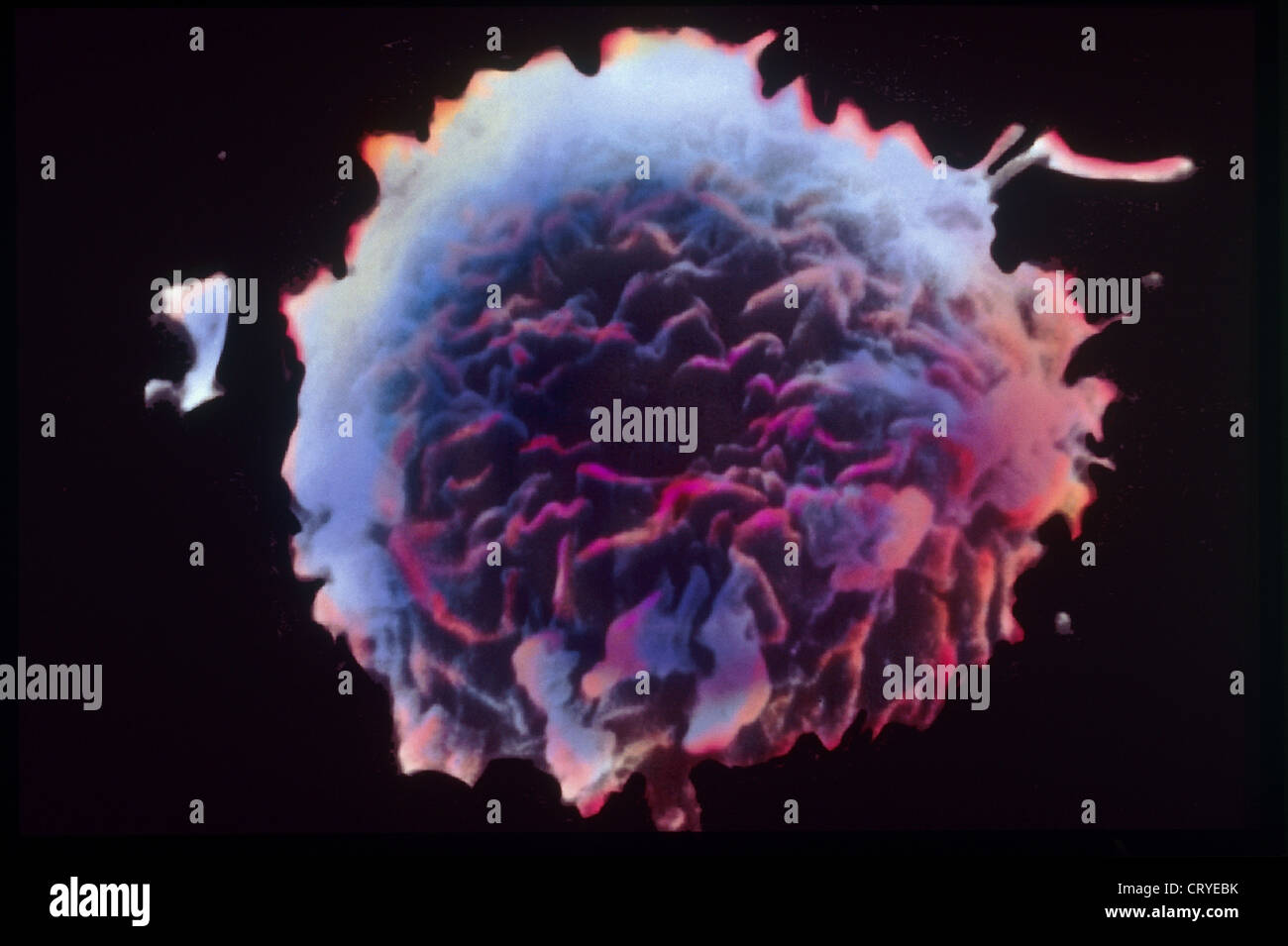 Macrophage Stock Photos & Macrophage Stock Images - Alamy