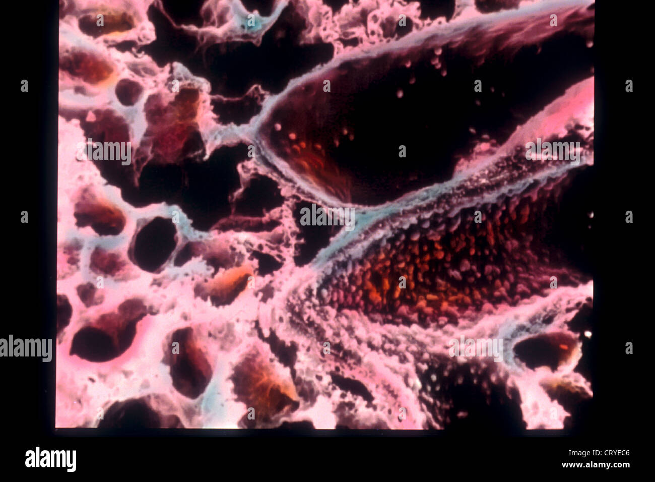Lung alveolus micrograph hi-res stock photography and images - Alamy