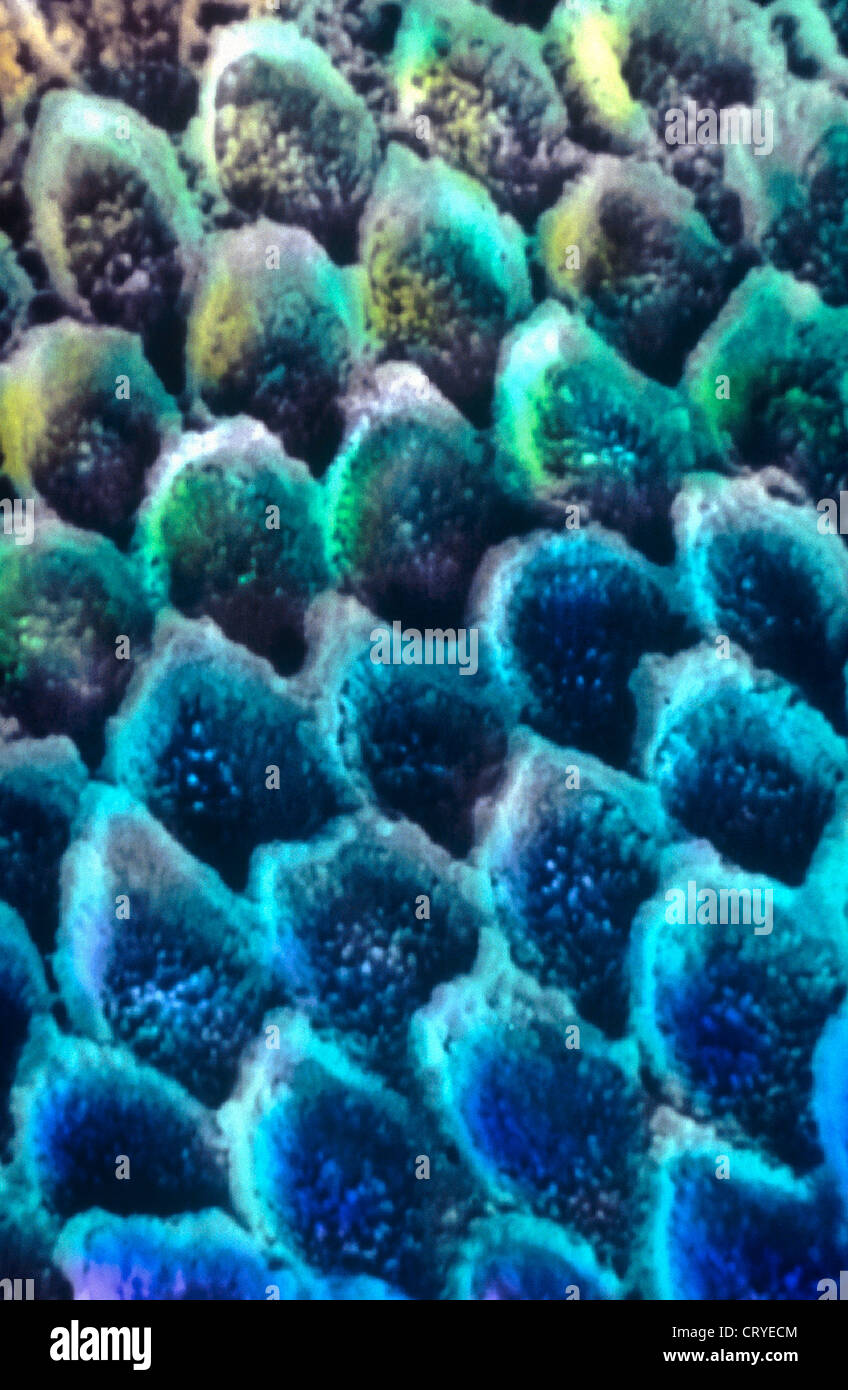 Tooth enamel microscope hi-res stock photography and images - Alamy