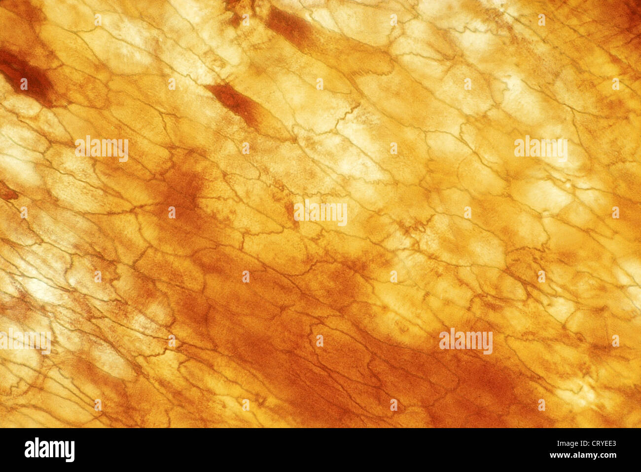 Peritoneum hi-res stock photography and images - Alamy