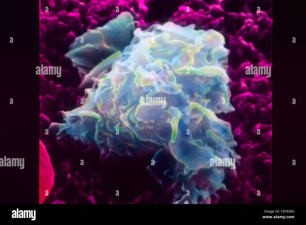 Hairy cell hi-res stock photography and images - Alamy