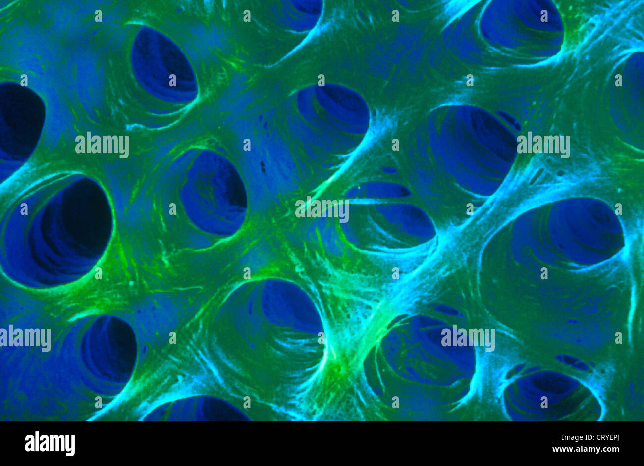 Dentin sem hi-res stock photography and images - Alamy