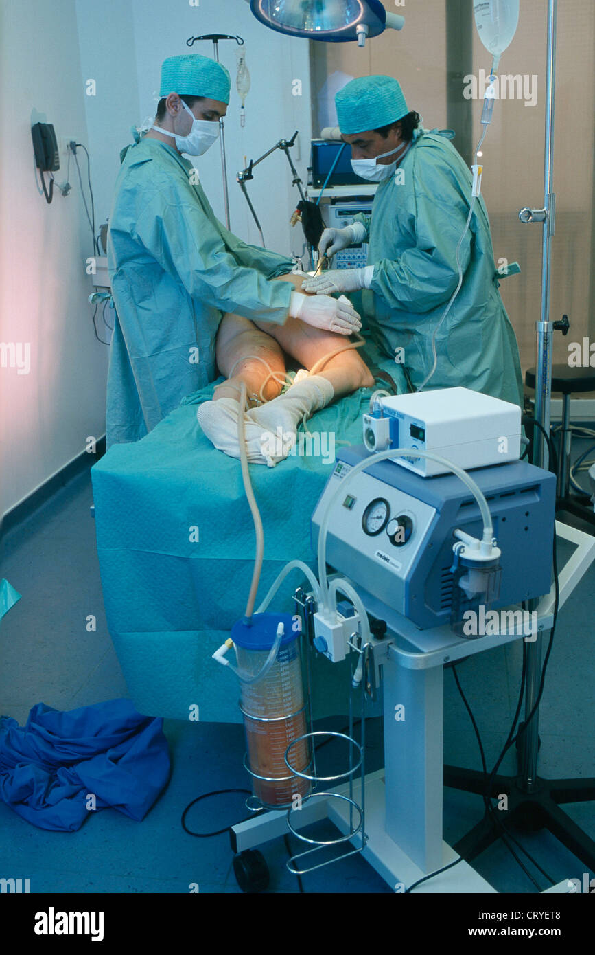 Fat suction woman hi-res stock photography and images - Alamy