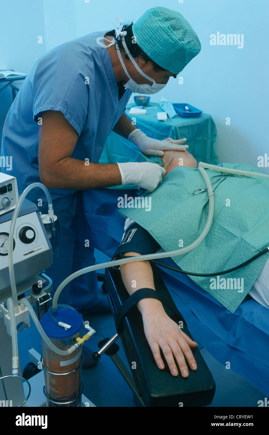 Fat suction woman hi-res stock photography and images - Alamy