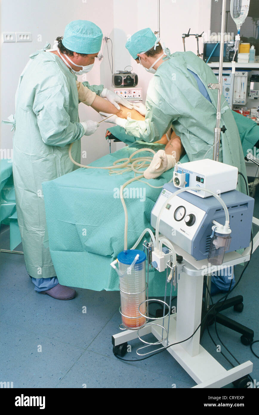 Fat suction woman hi-res stock photography and images - Alamy