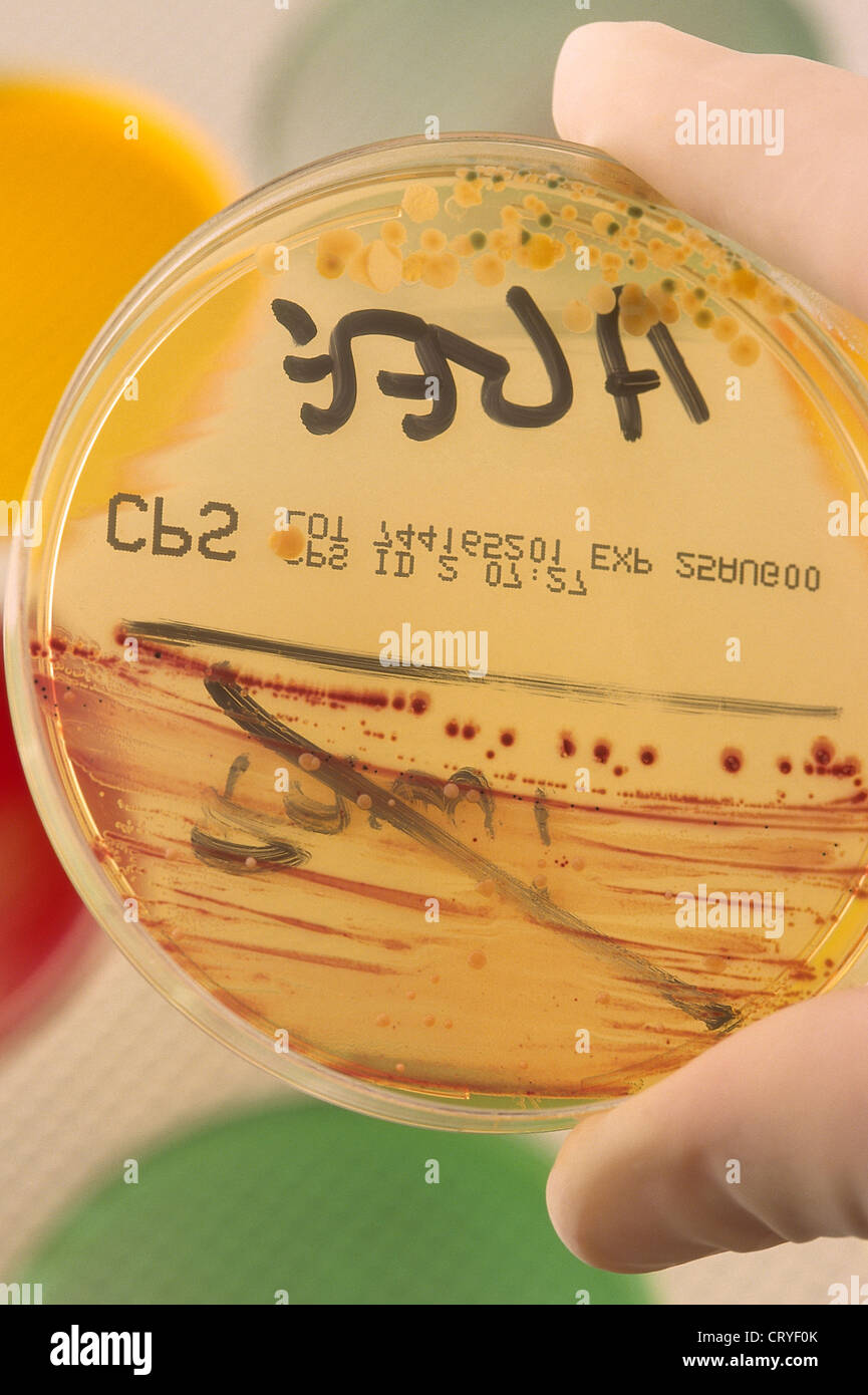 Escherichia coli colonies hi-res stock photography and images - Alamy