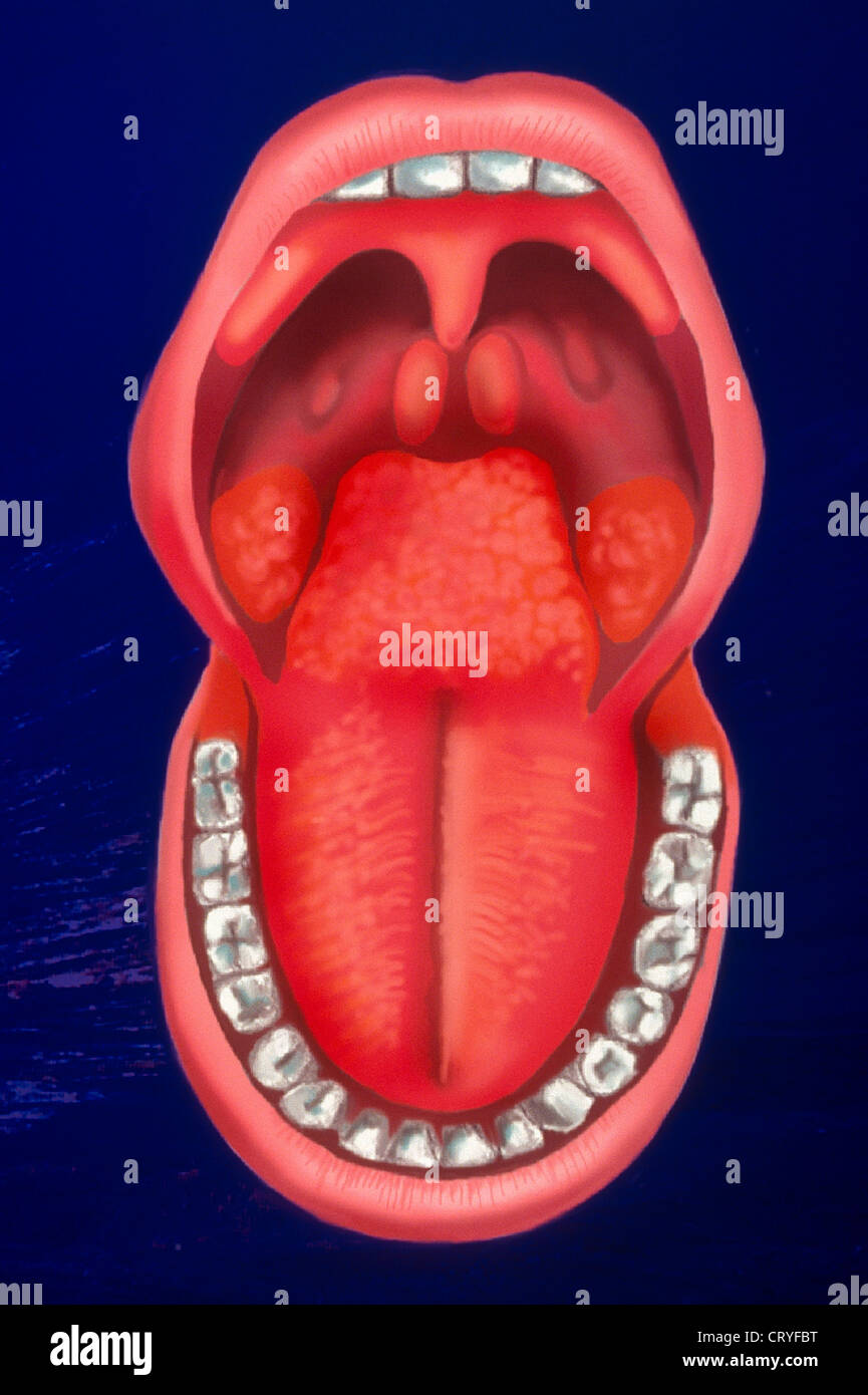 Lingual tonsil hi-res stock photography and images - Alamy