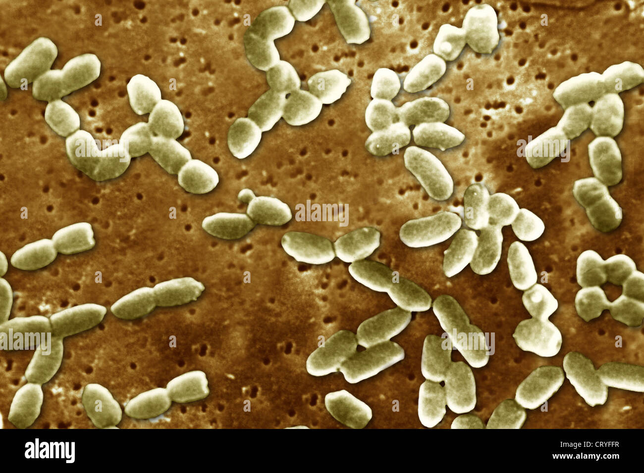 Pseudomonas aeruginosa microscope hi-res stock photography and images ...