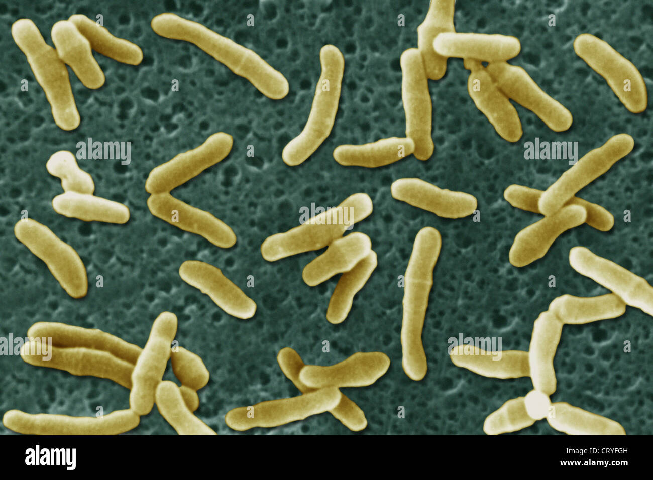Corynebacterium diphtheriae hi-res stock photography and images - Alamy