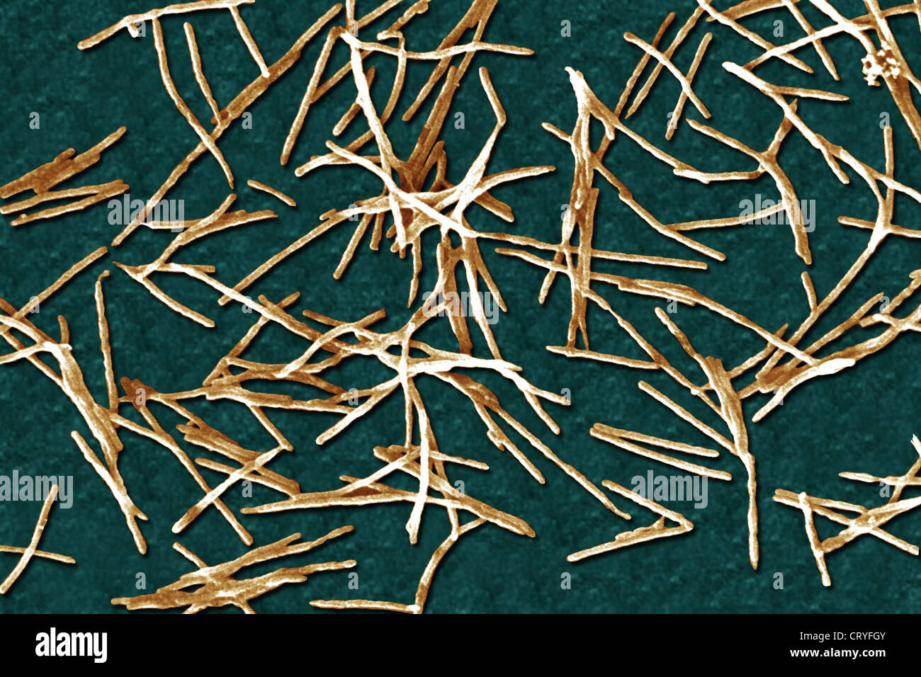 Fusobacterium hi-res stock photography and images - Alamy