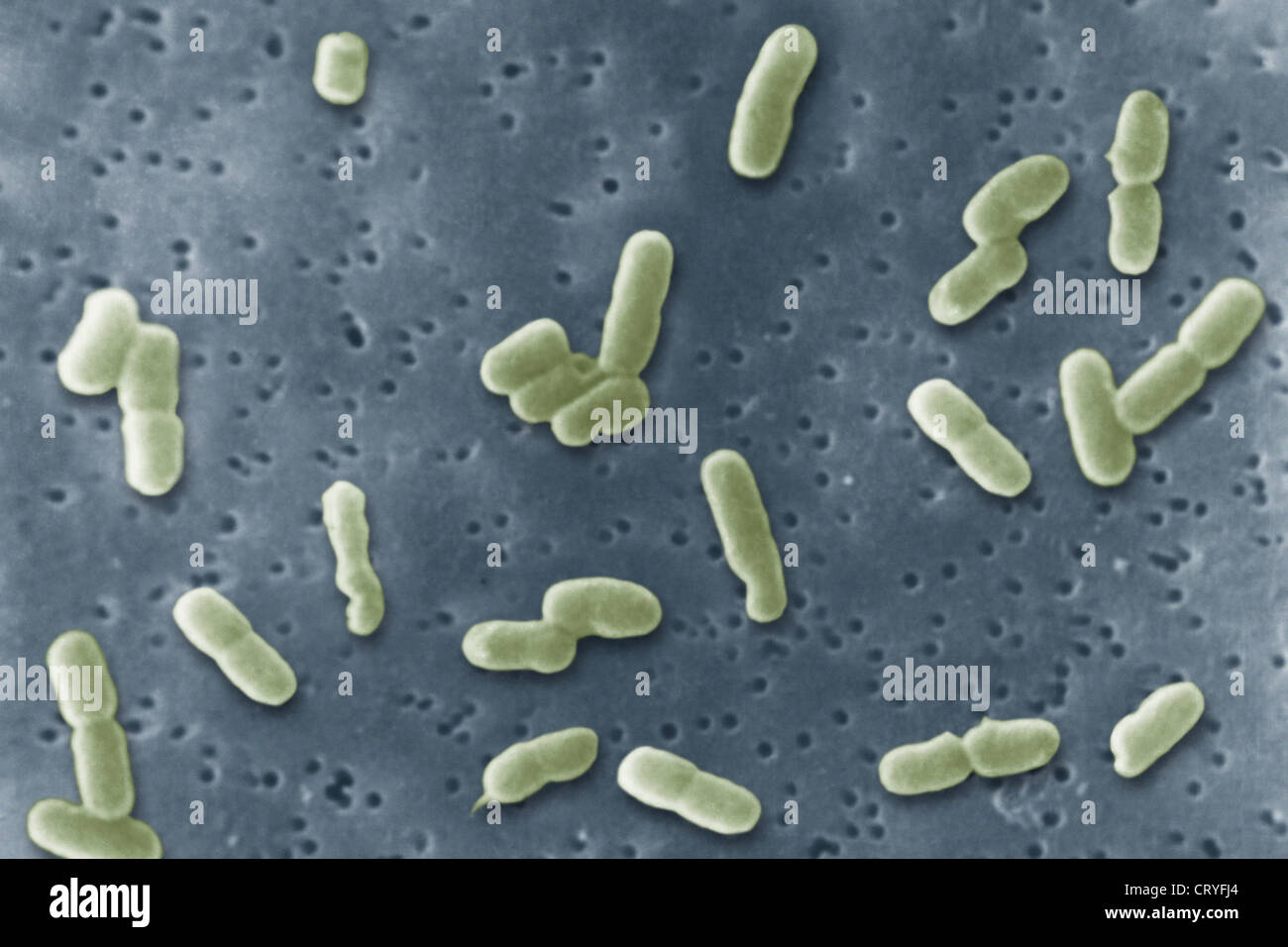 Shigella sonnei hi-res stock photography and images - Alamy