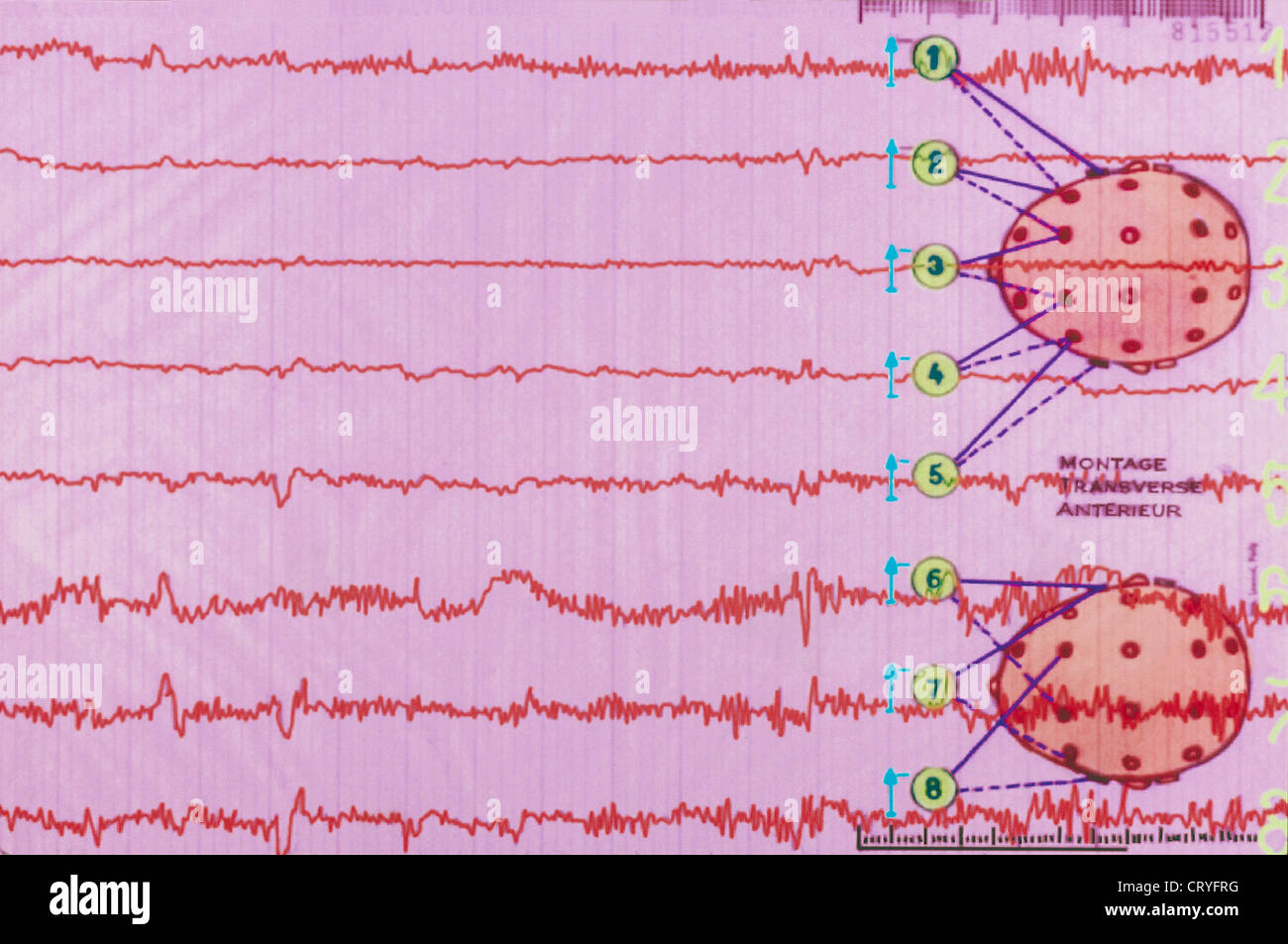 EEG Stock Photo: 49162948 - Alamy