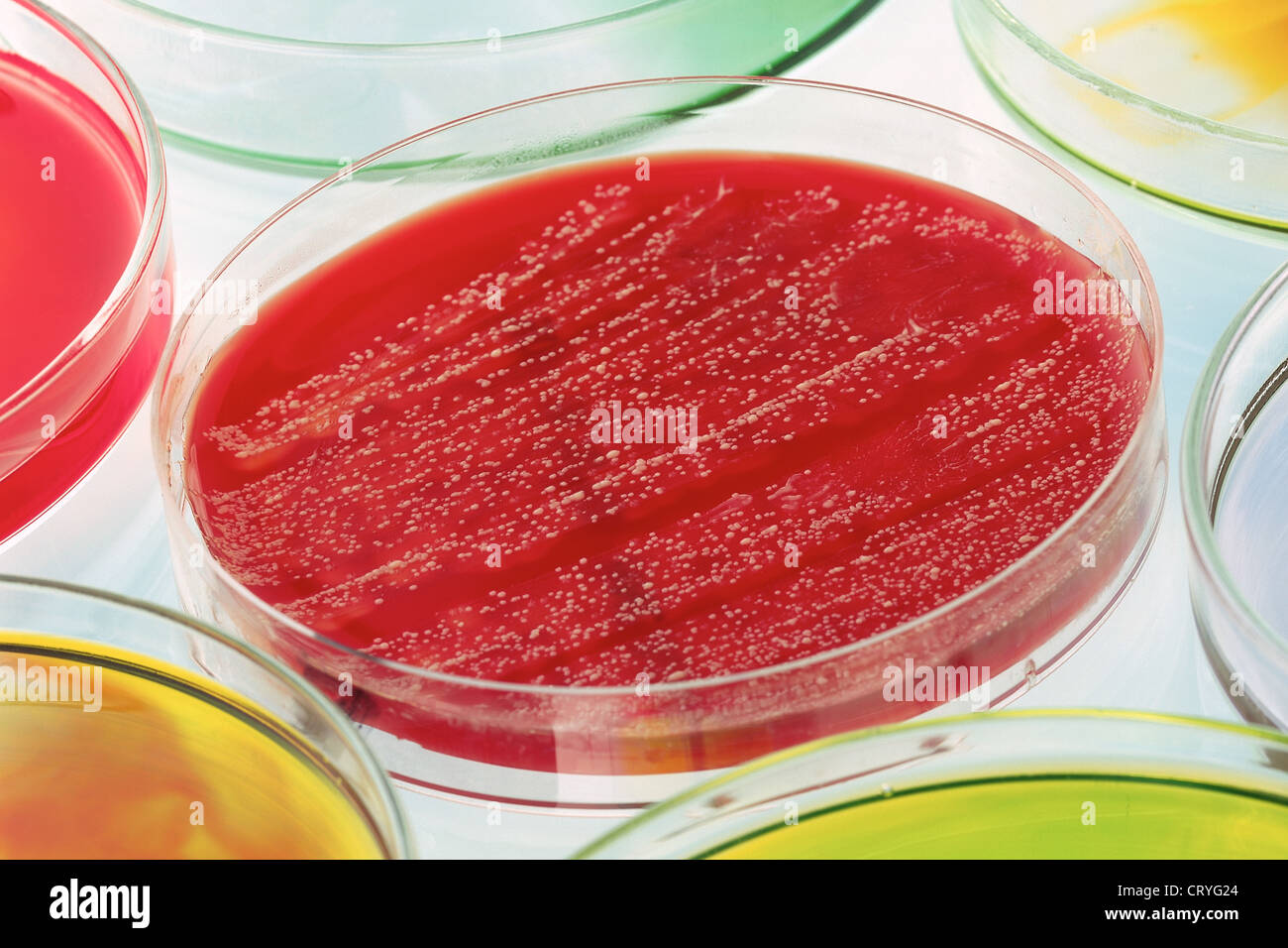 Streptococcus group b hi-res stock photography and images - Alamy