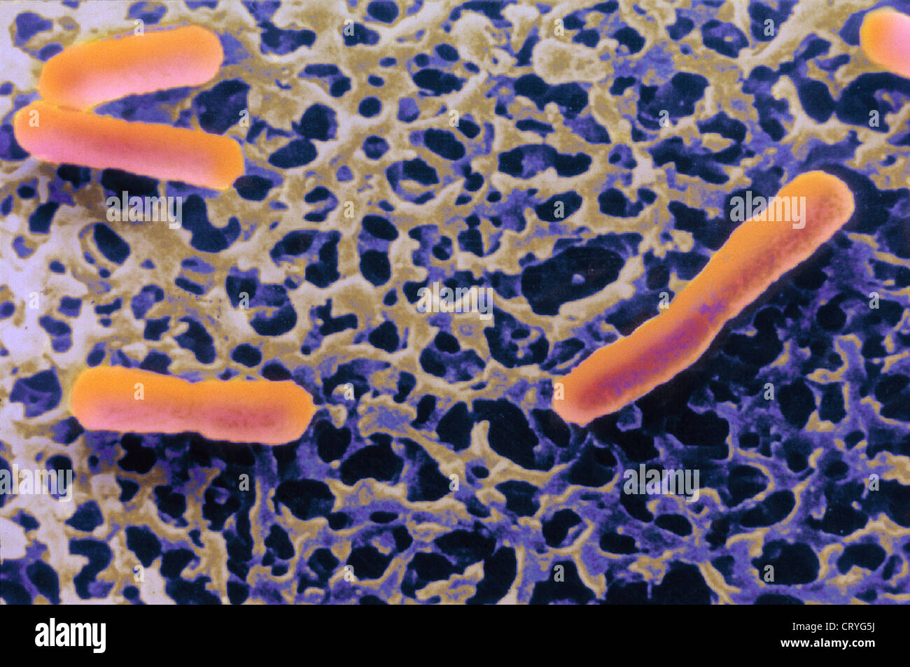 Shigella bacteria hi-res stock photography and images - Alamy