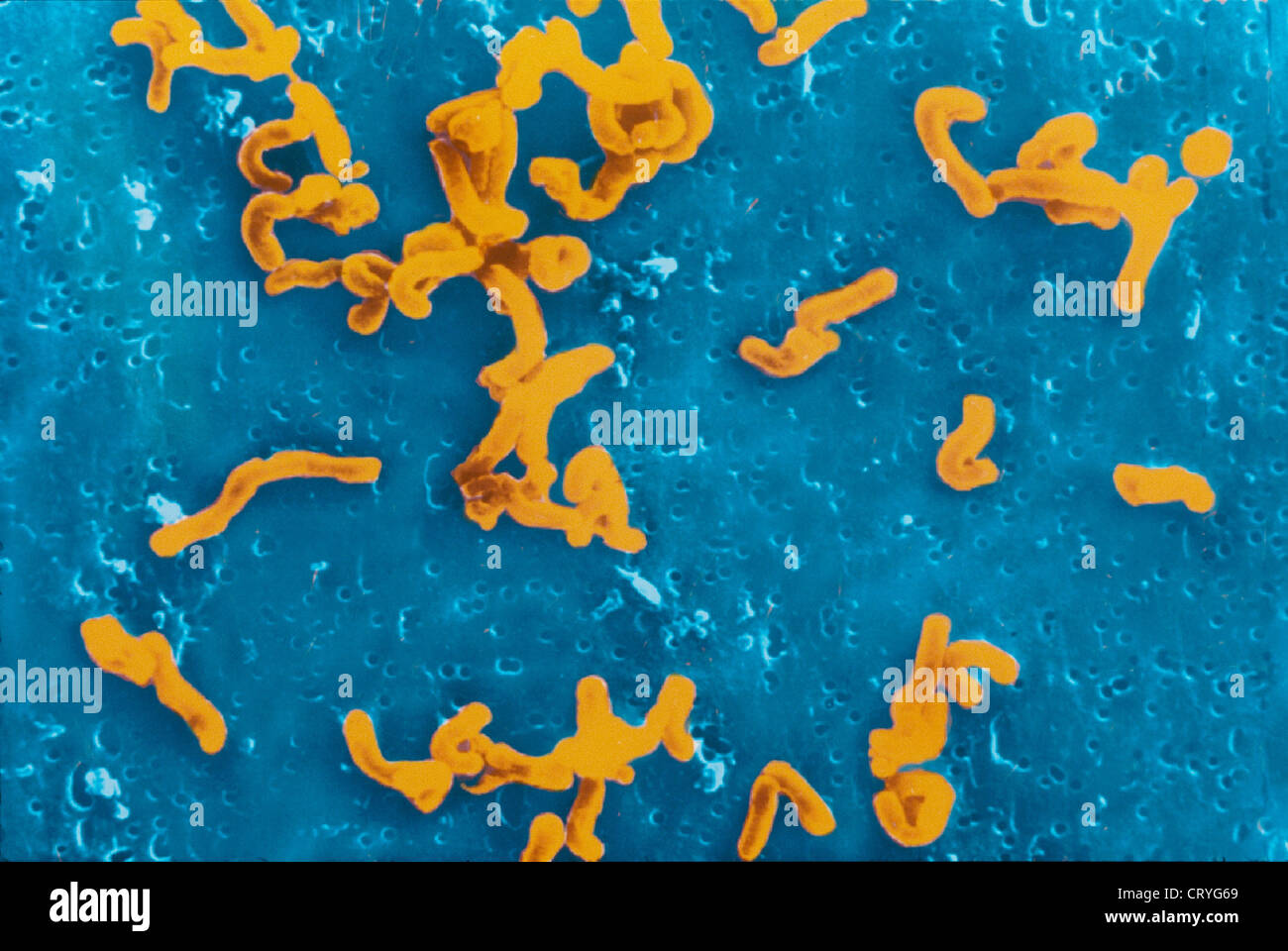 Helicobacter pylori microscope hi-res stock photography and images - Alamy
