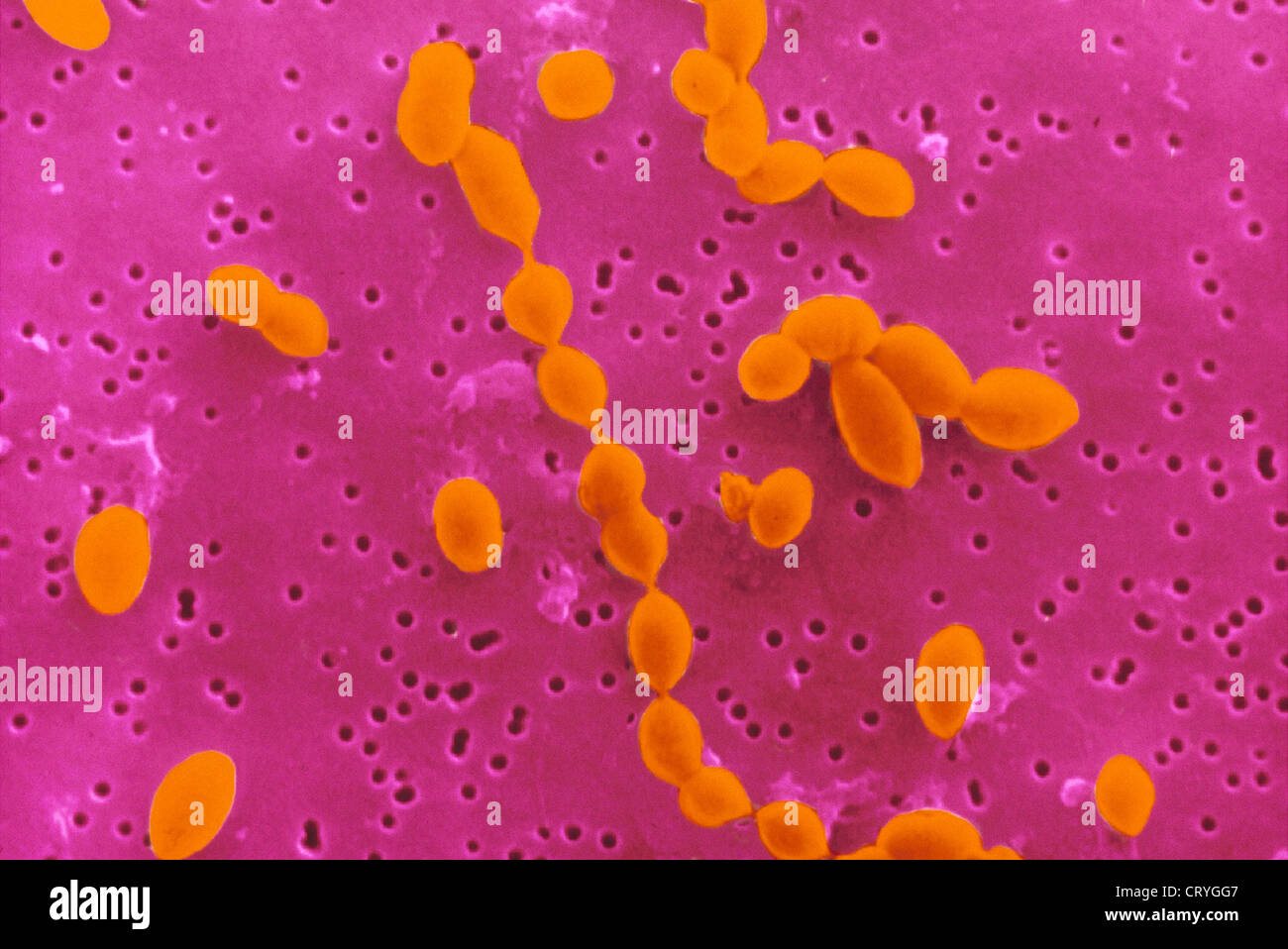 Streptococcus pneumoniae microscope hi-res stock photography and images ...