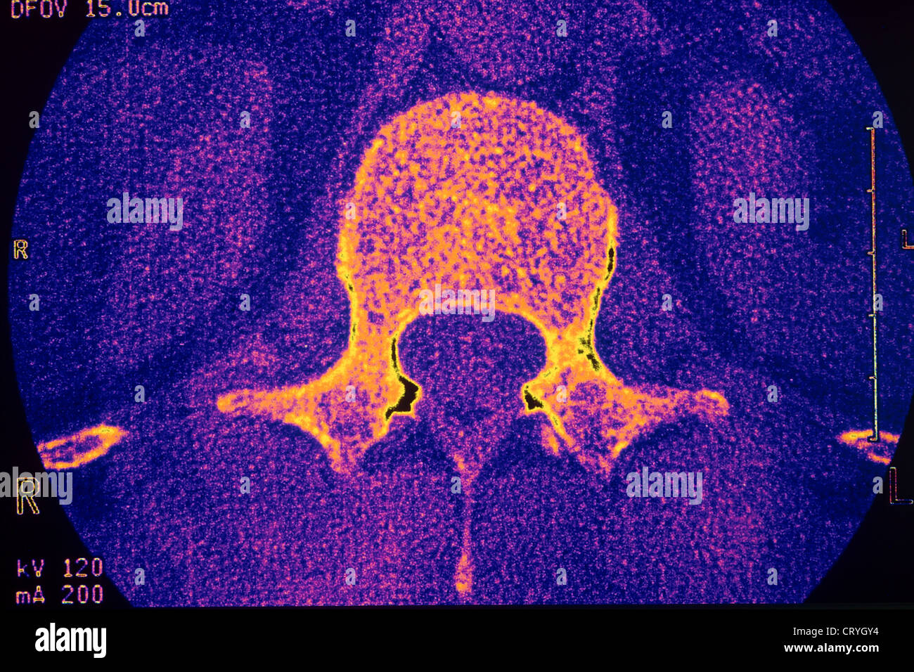 Osteides hi-res stock photography and images - Alamy