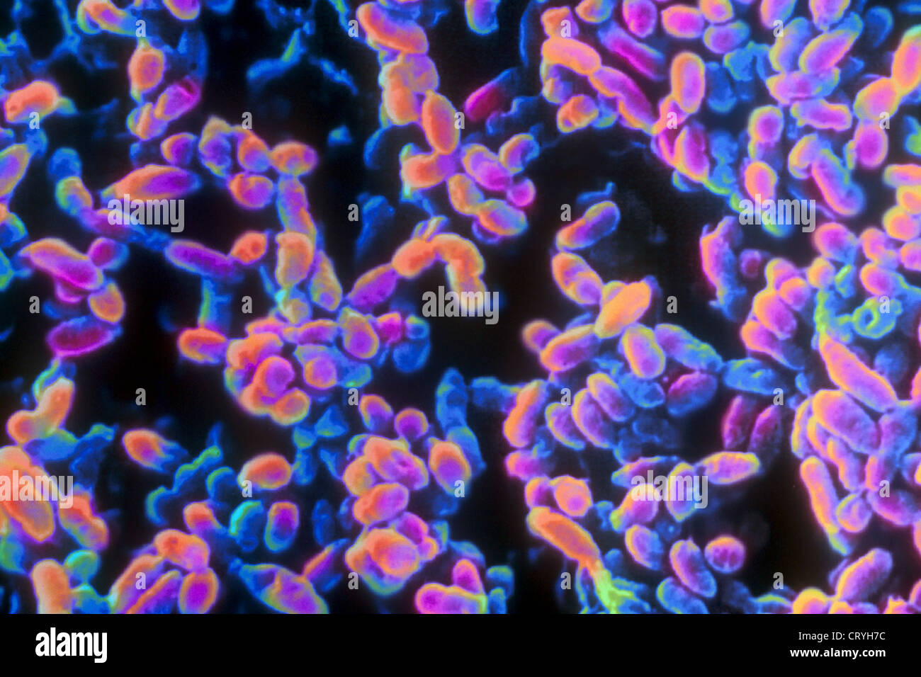 Haemophilus Influenzae High Resolution Stock Photography and Images - Alamy