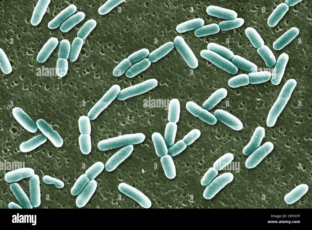 Escherichia coli sem hi-res stock photography and images - Alamy
