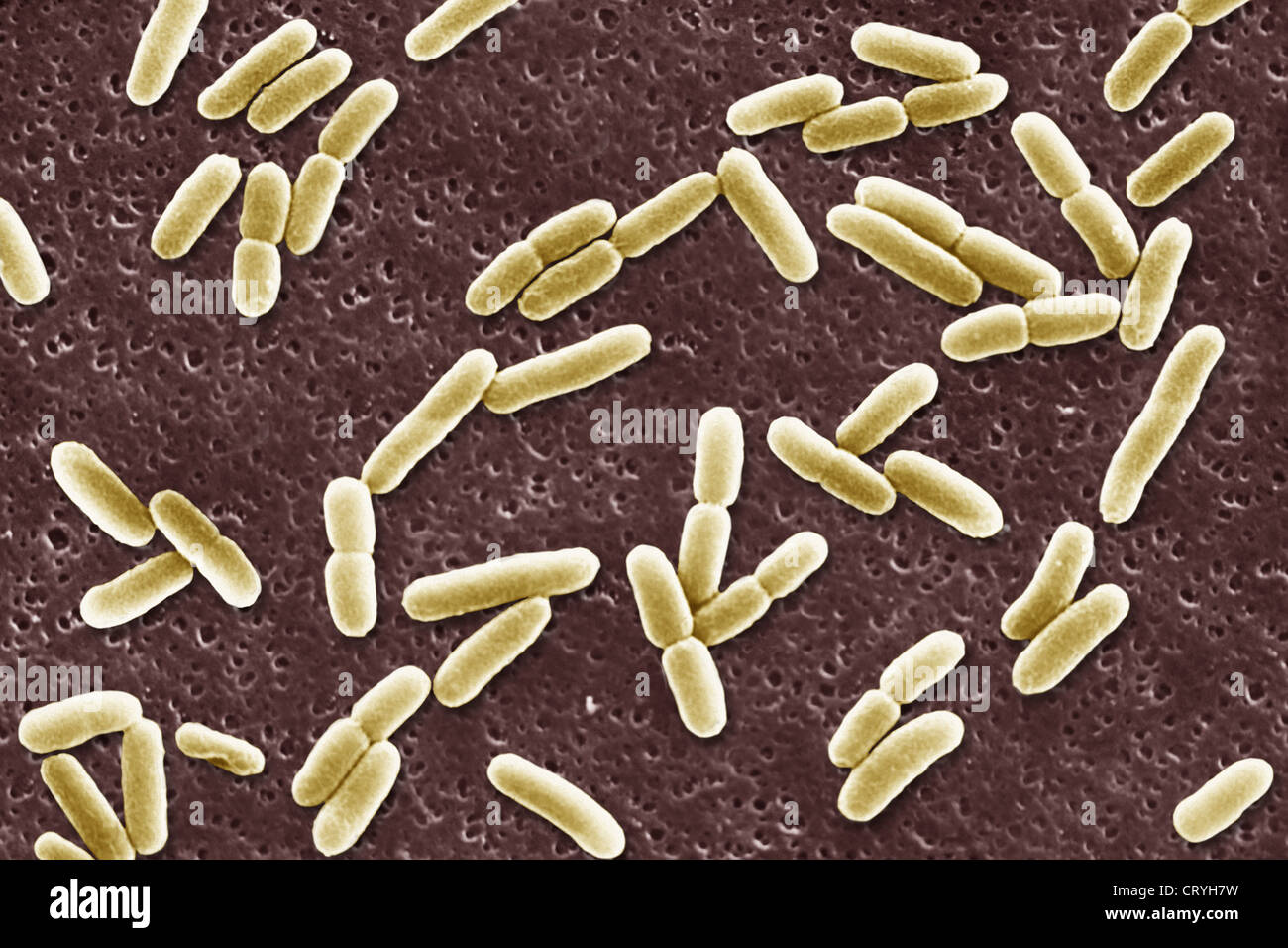 Escherichia coli micrograph hi-res stock photography and images - Alamy