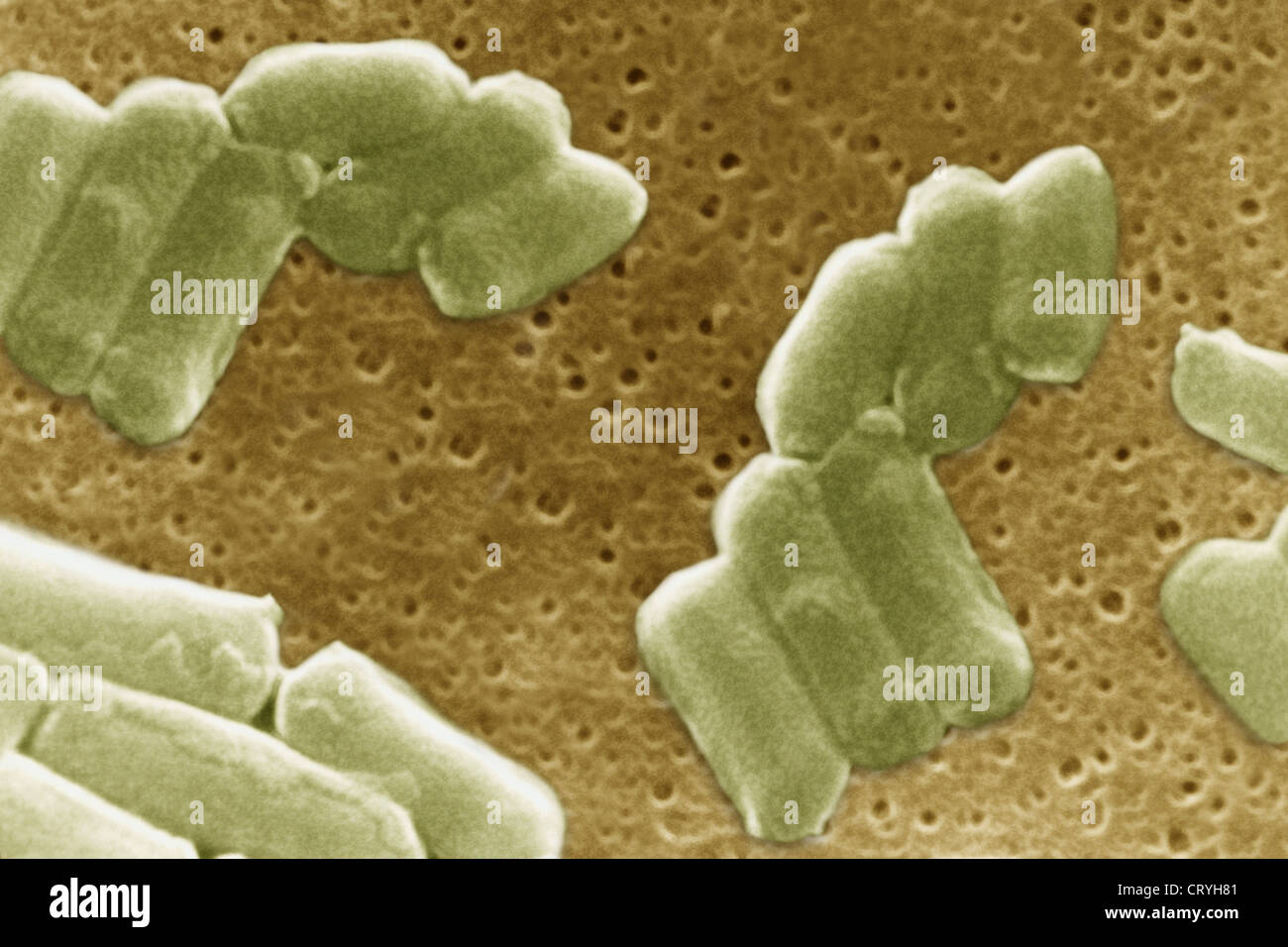 Clostridium perfringens bacteria hi-res stock photography and images ...