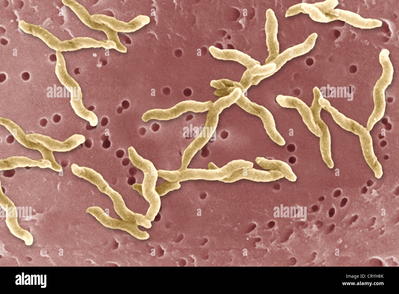 Campylobacter jejuni hi-res stock photography and images - Alamy