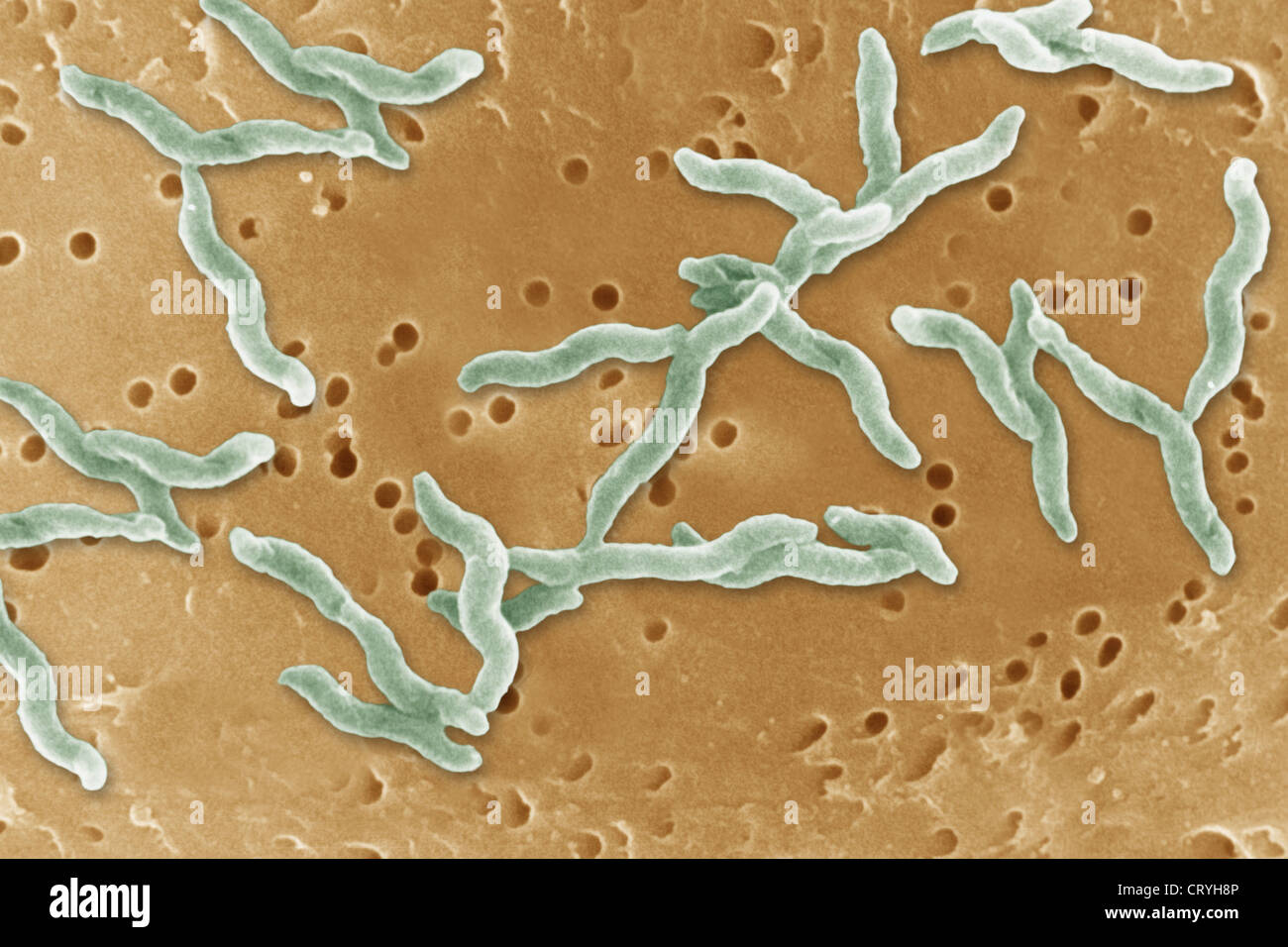 Campylobacter jejuni hi-res stock photography and images - Alamy