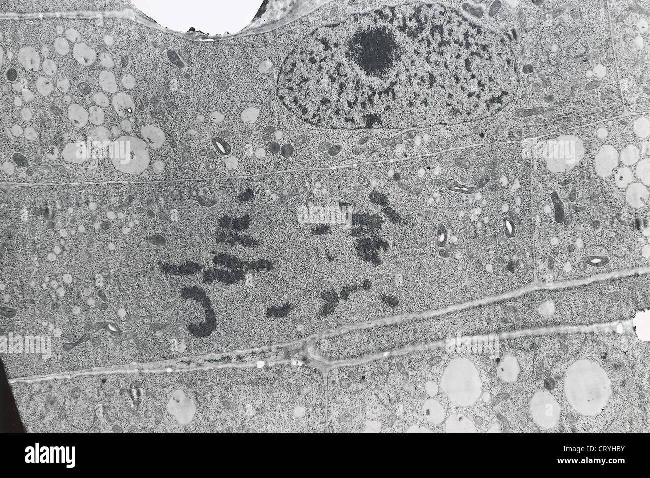 Anaphase hi-res stock photography and images - Alamy