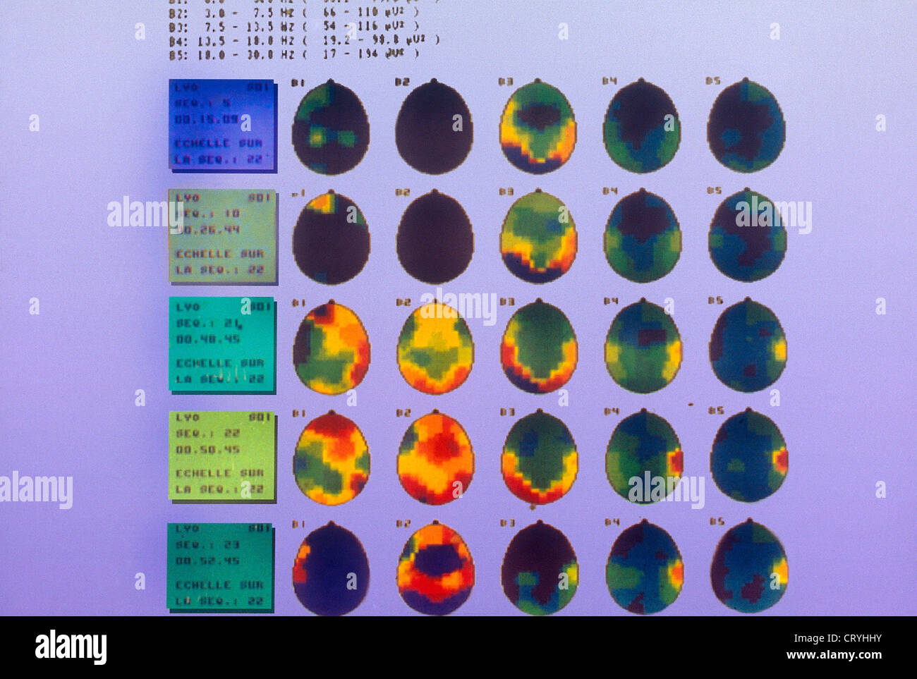 Brain map sleep hi-res stock photography and images - Alamy