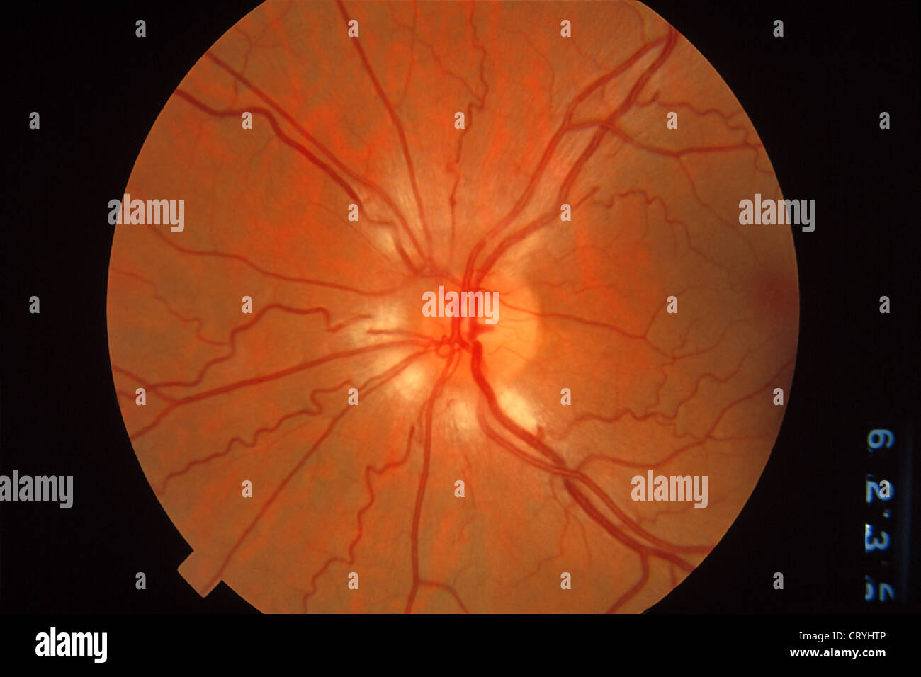 Retinography hi-res stock photography and images - Alamy