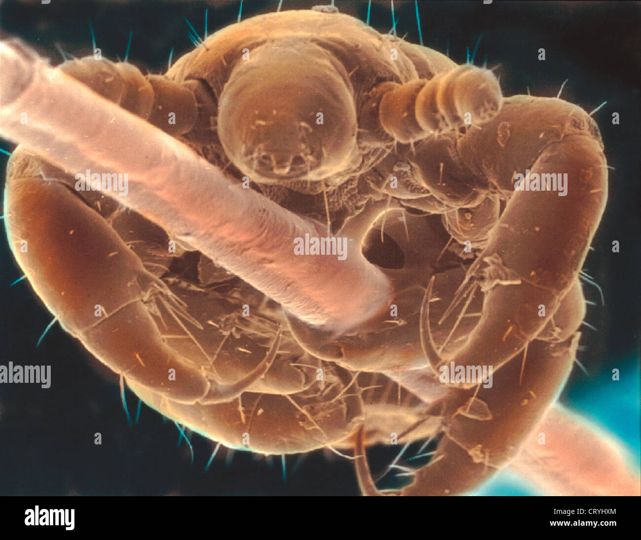 Head Louse Microscope High Resolution Stock Photography and Images - Alamy