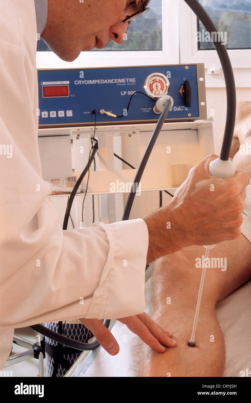 Cryosurgery hi-res stock photography and images - Alamy