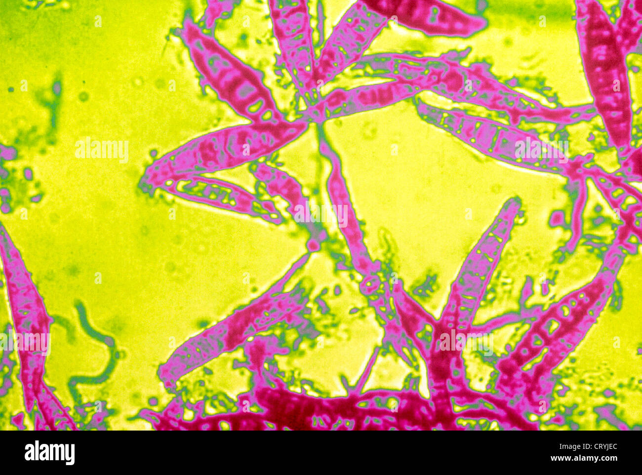 Microsporum Canis High Resolution Stock Photography and Images - Alamy