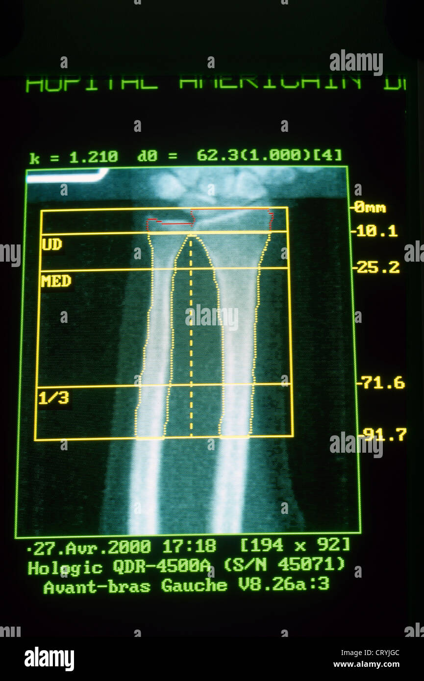 Bmd testing hi-res stock photography and images - Alamy