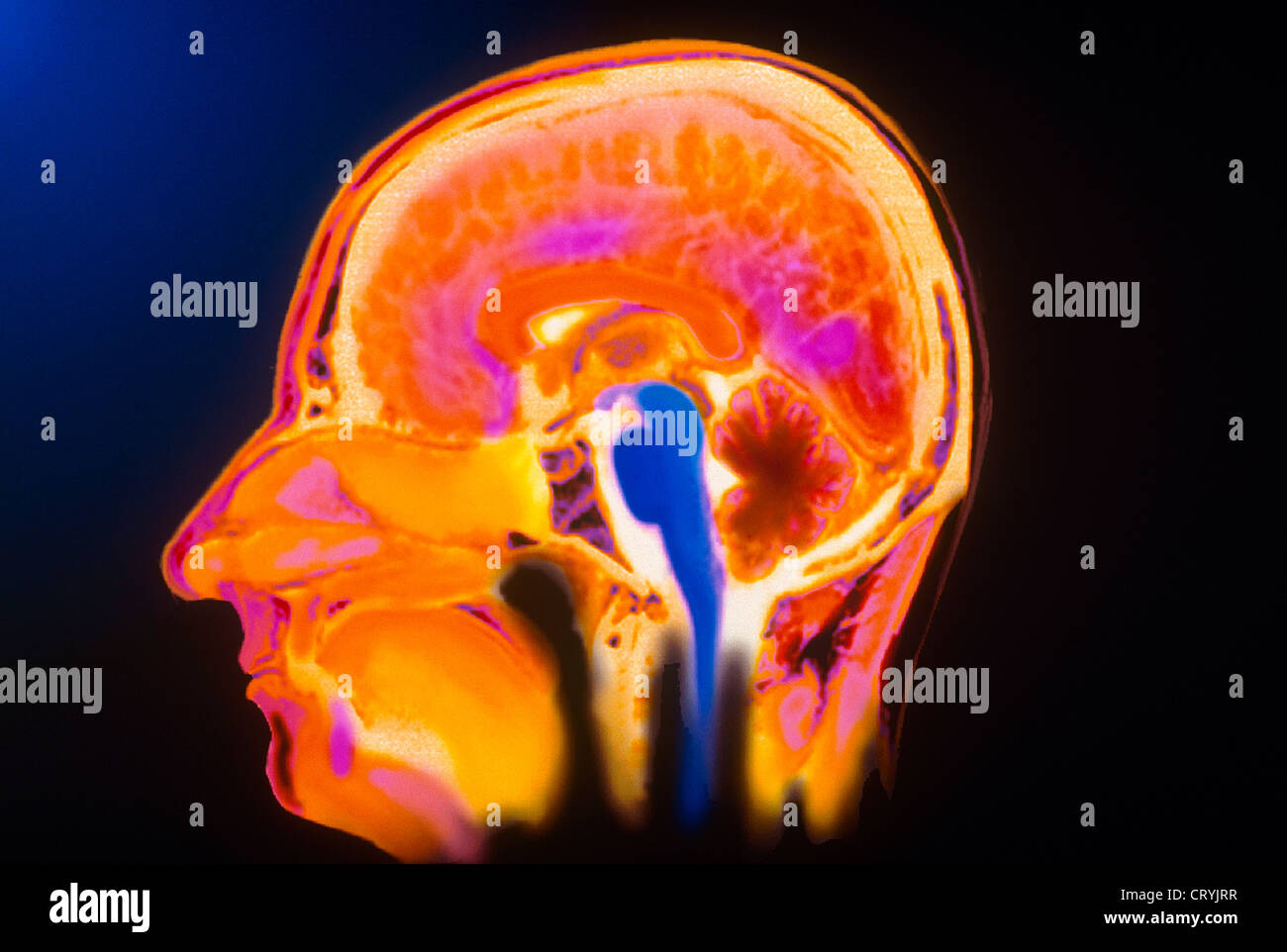 Nmr brain scan hi-res stock photography and images - Alamy