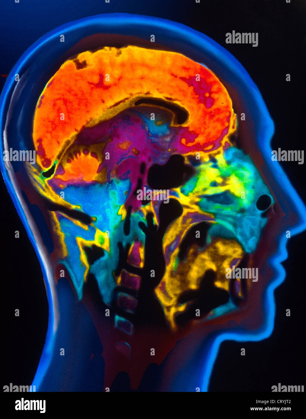 Brain stem test hi-res stock photography and images - Alamy
