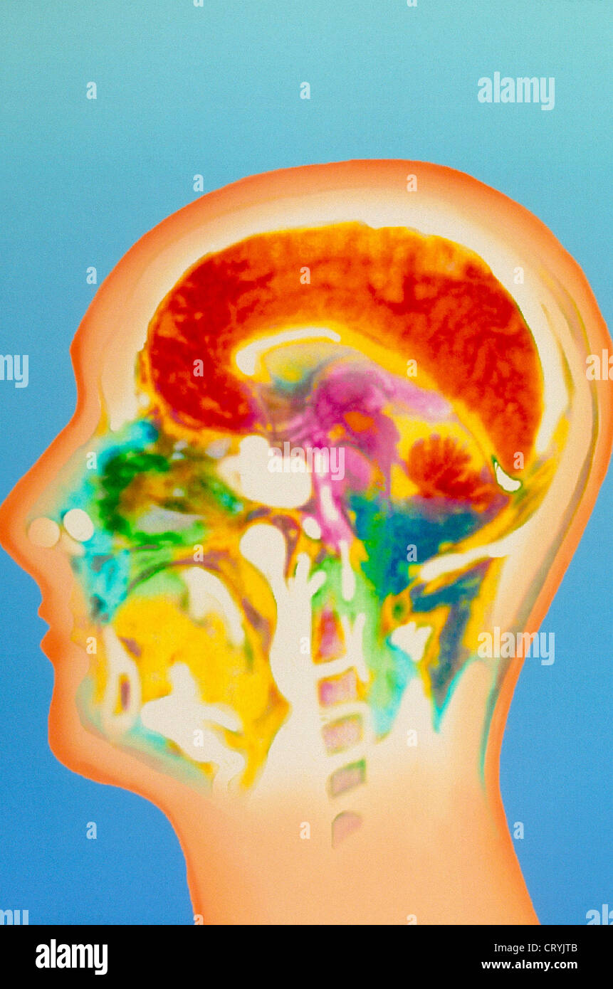 Brain stem test hi-res stock photography and images - Alamy