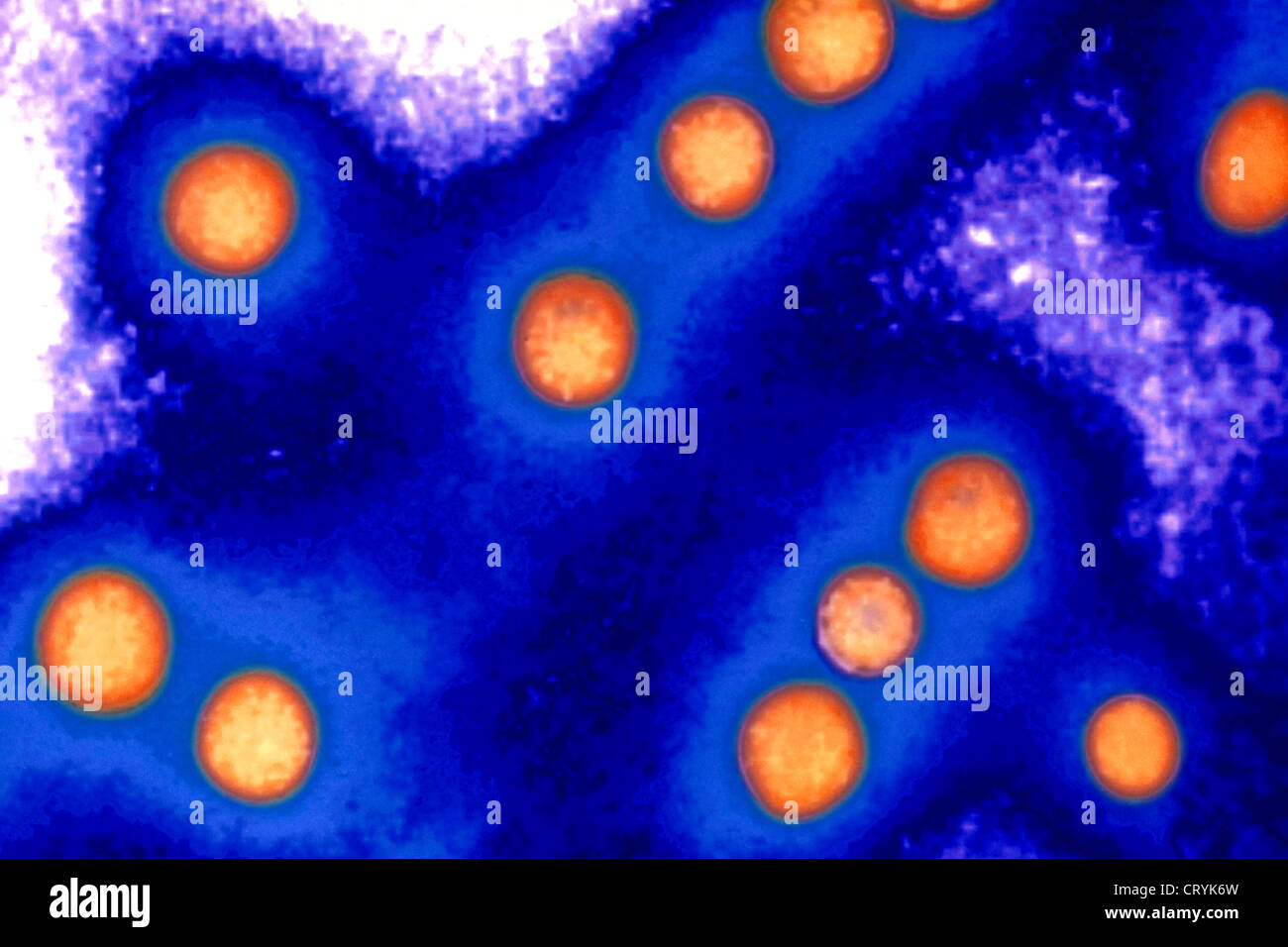 Picornavirus hi-res stock photography and images - Alamy