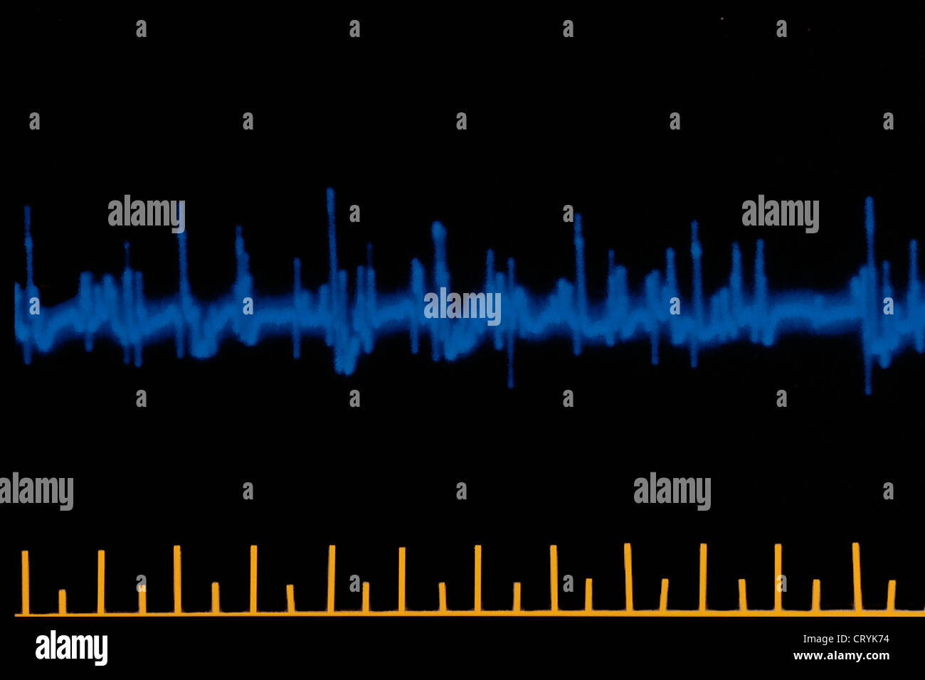 Electromyogram hi-res stock photography and images - Alamy