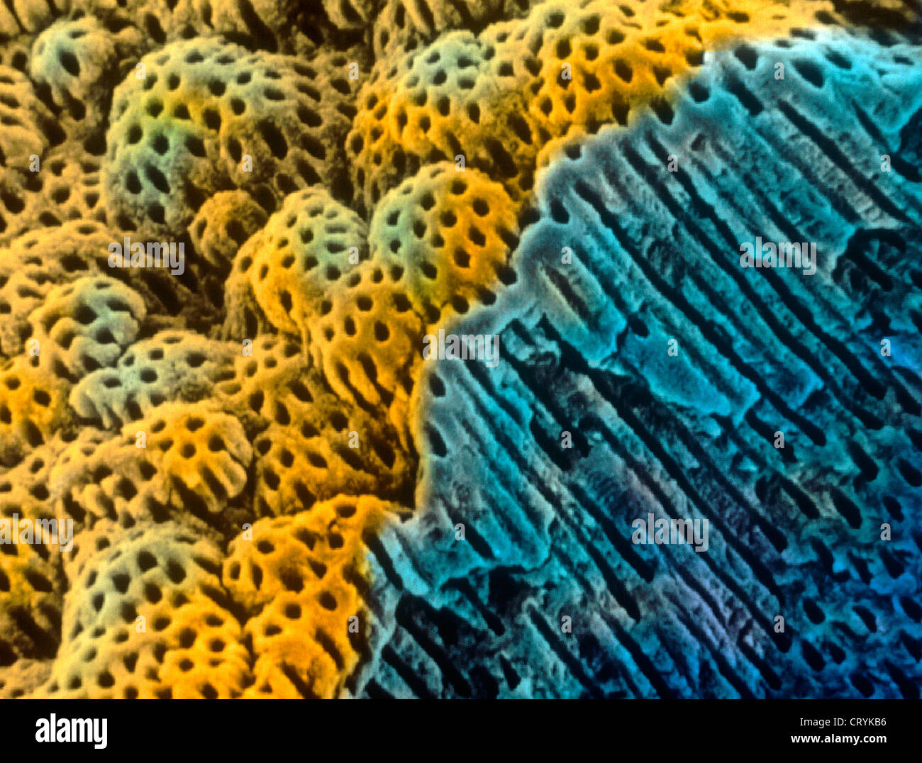 Dentin sem hi-res stock photography and images - Alamy