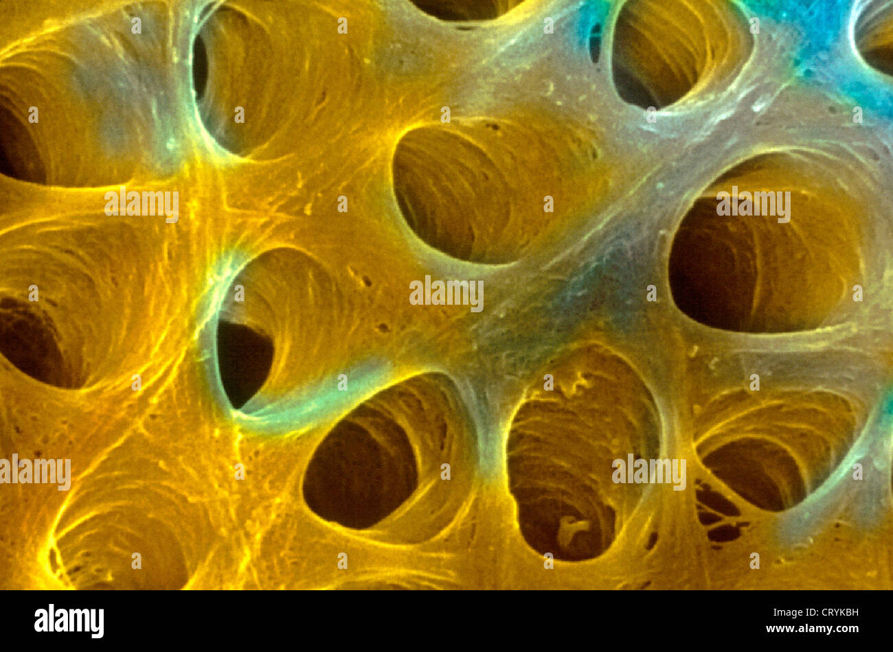 Dentinal tubules hi-res stock photography and images - Alamy