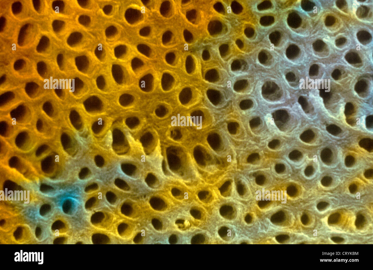 Dentinal Tubules High Resolution Stock Photography and Images - Alamy