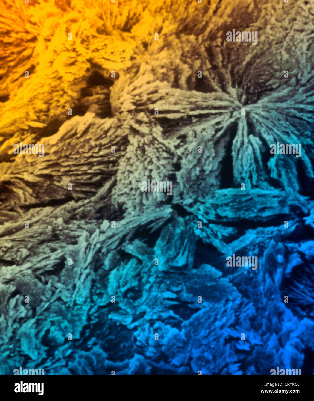 DENTAL TARTAR, SEM Stock Photo - Alamy