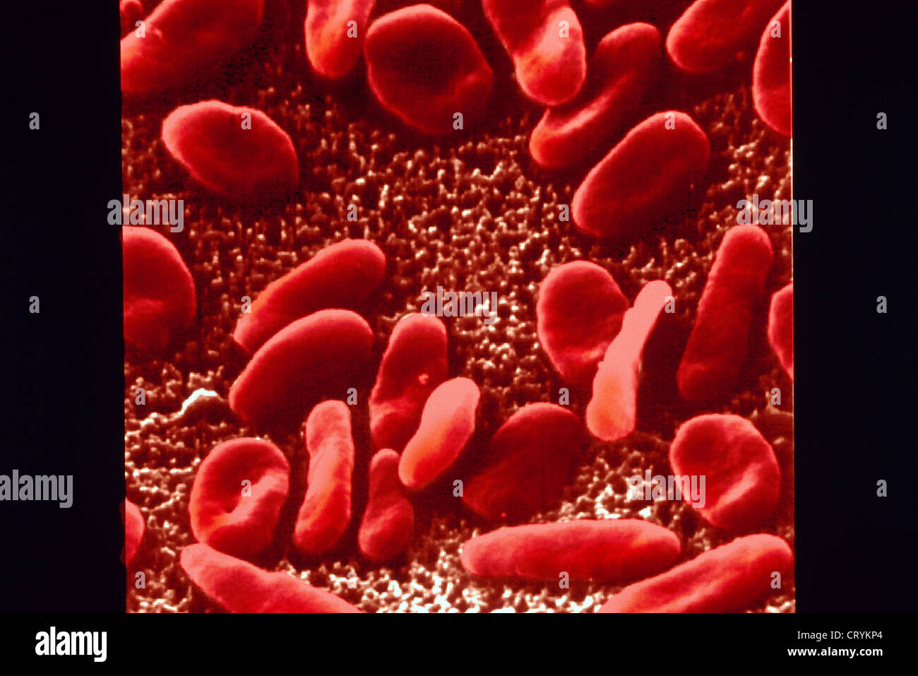 Ovalocytes hi-res stock photography and images - Alamy