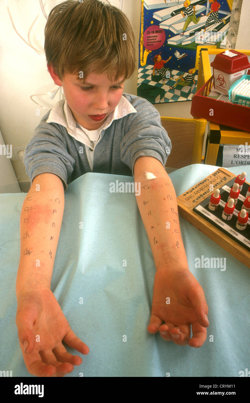 ALLERGY TEST, CHILD Stock Photo - Alamy
