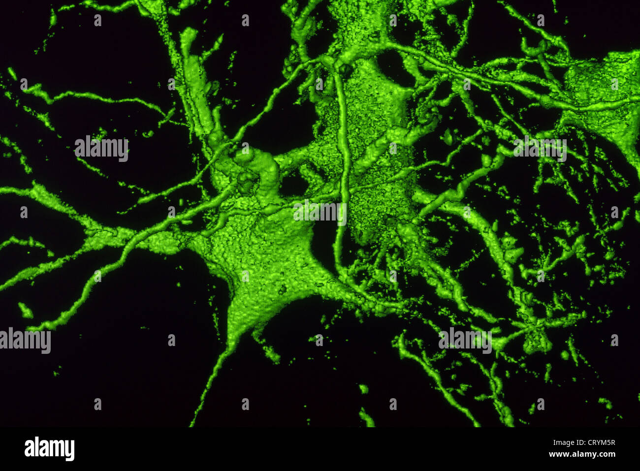 Nerve cell micrograph hi-res stock photography and images - Alamy