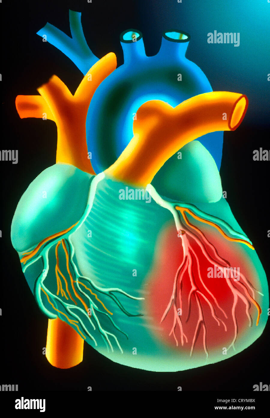 HEART ATTACK, DRAWING Stock Photo - Alamy